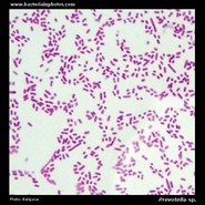 Bacteria under microscope - microscopic appearance of bacteria ...