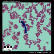 Bacteria under microscope - microscopic appearance of bacteria ...