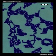 Bacteria under microscope - microscopic appearance of bacteria ...