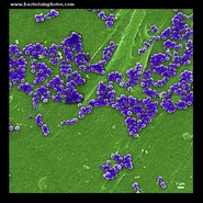 Bacteria under microscope - microscopic appearance of bacteria ...