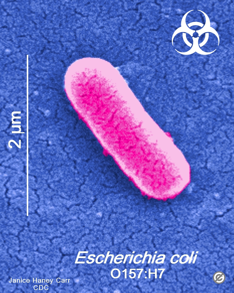 Bacteria under microscope - microscopic appearance of bacteria ...