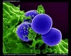 Gallery of bacteria - photo gallery of bacterial species. Images of ...