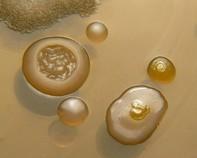 Bacterial colonies - examples of morphology of various colonies of ...