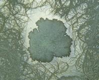 Bacterial colonies - examples of morphology of various colonies of ...